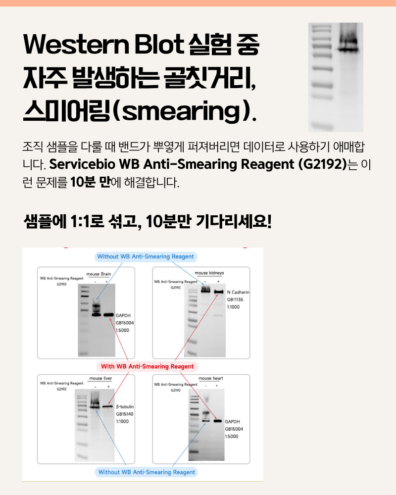 newsletter - gfk - servicebio Distributor